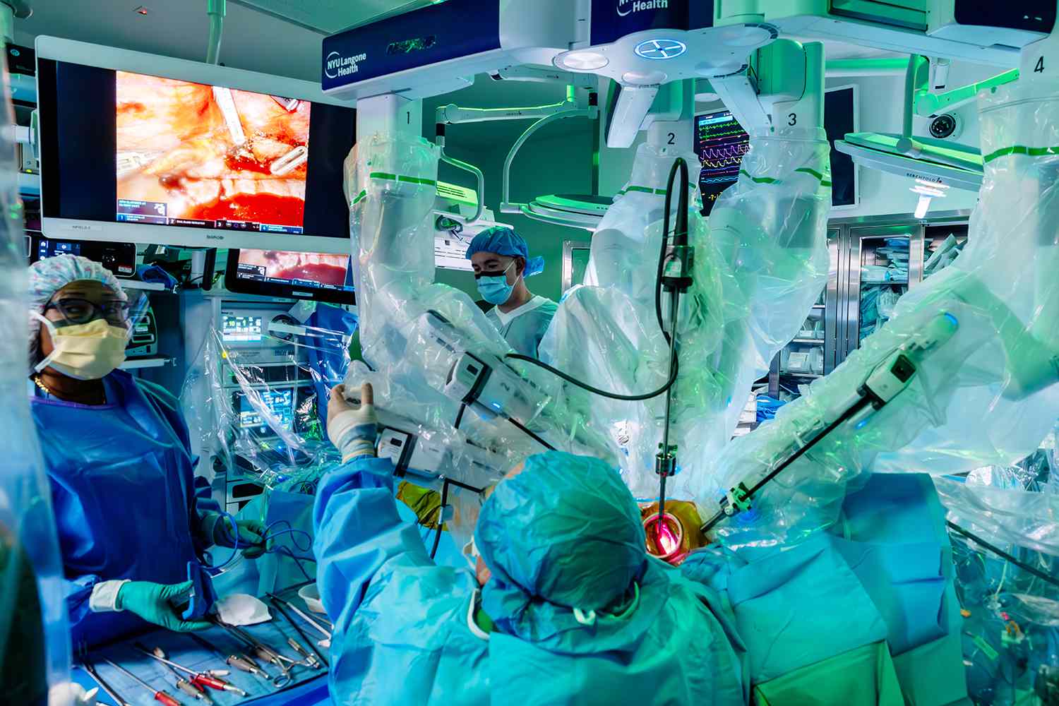 Chirurgii au realizat cu succes primul transplant robotic de doi ...