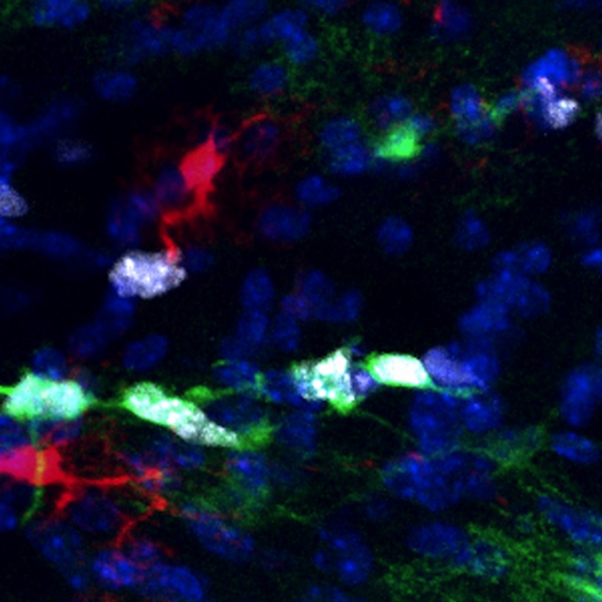 Descoperirea unui tip de celule cerebrale neobservate până acum