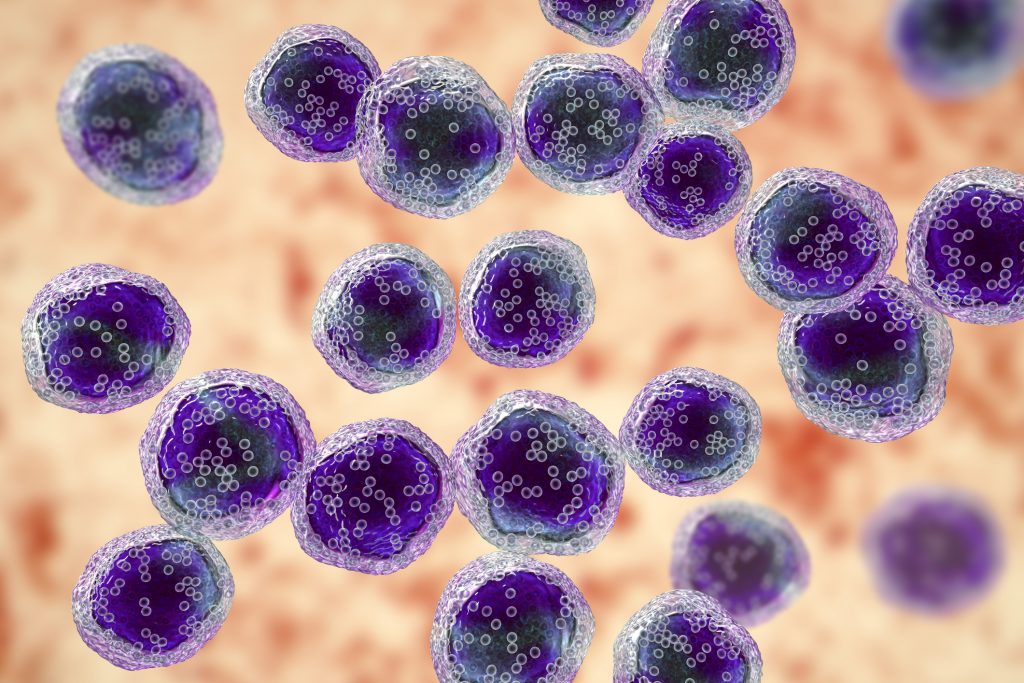 Biopsia Lichidă: Speranță Nouă pentru Diagnosticarea Rapidă a ...